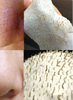 Mask acne (Acne Pore Pack, Base / No Color)