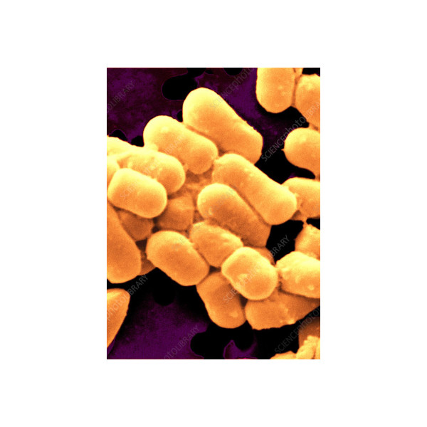 Lactobacillus fermentum (200 billion/g) (Freeze-dried)
