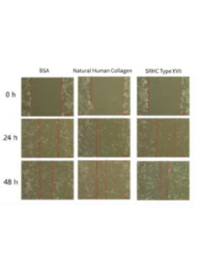 SRHC XVII (Recombinant human collagen type XVII, a1)